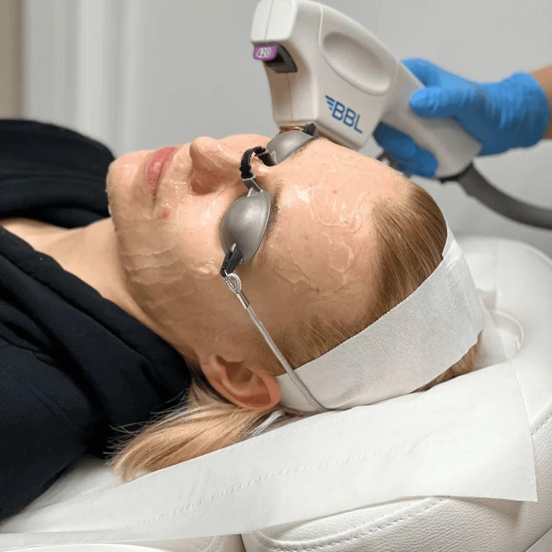 BBL & HydraFacial | Ultimate IPL Rejuvenation | Omniya Clinic London