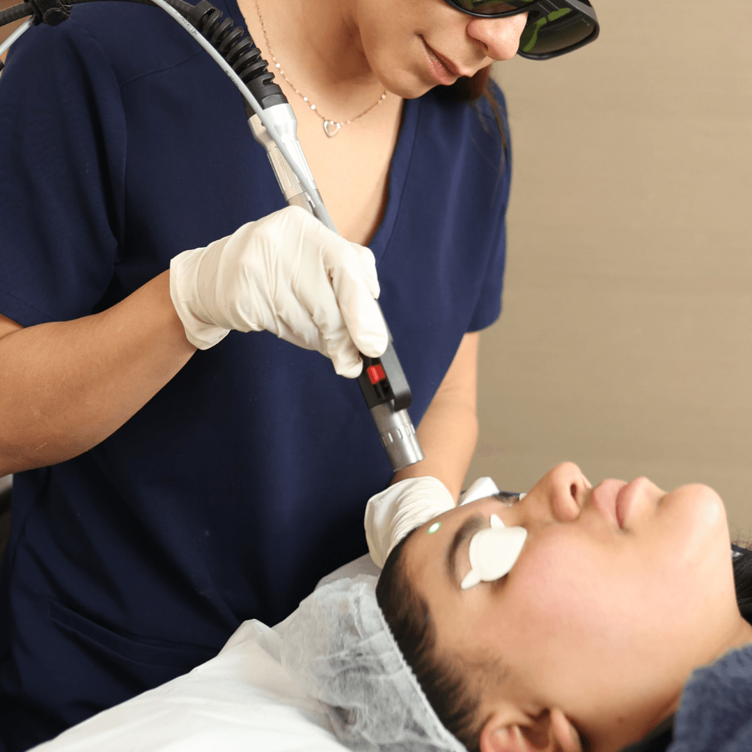 Laser For Veins (Skin Types I - IV) | Omniya Clinic London
