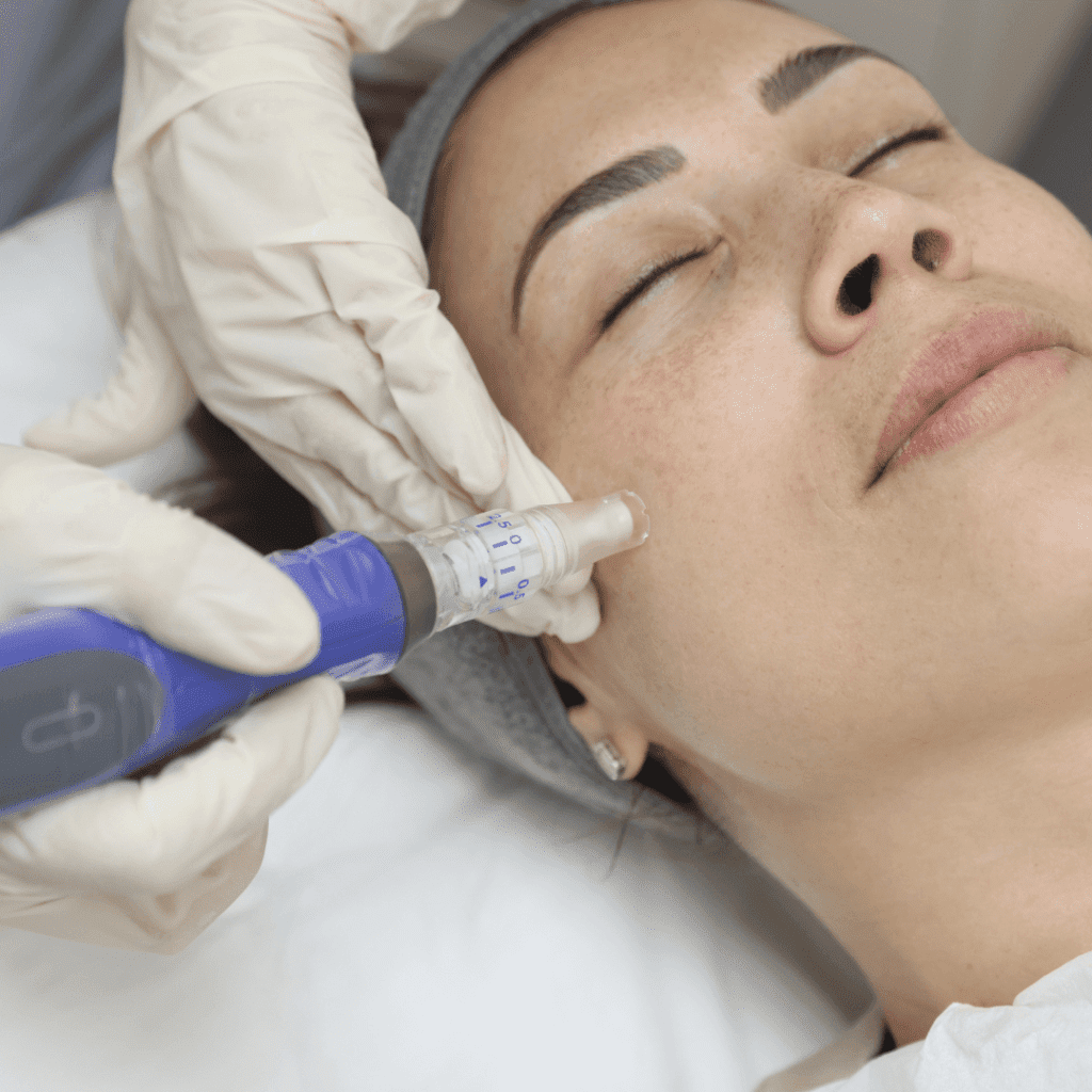 SkinPen Microneedling | Boost Collagen Production | Omniya Clinic London