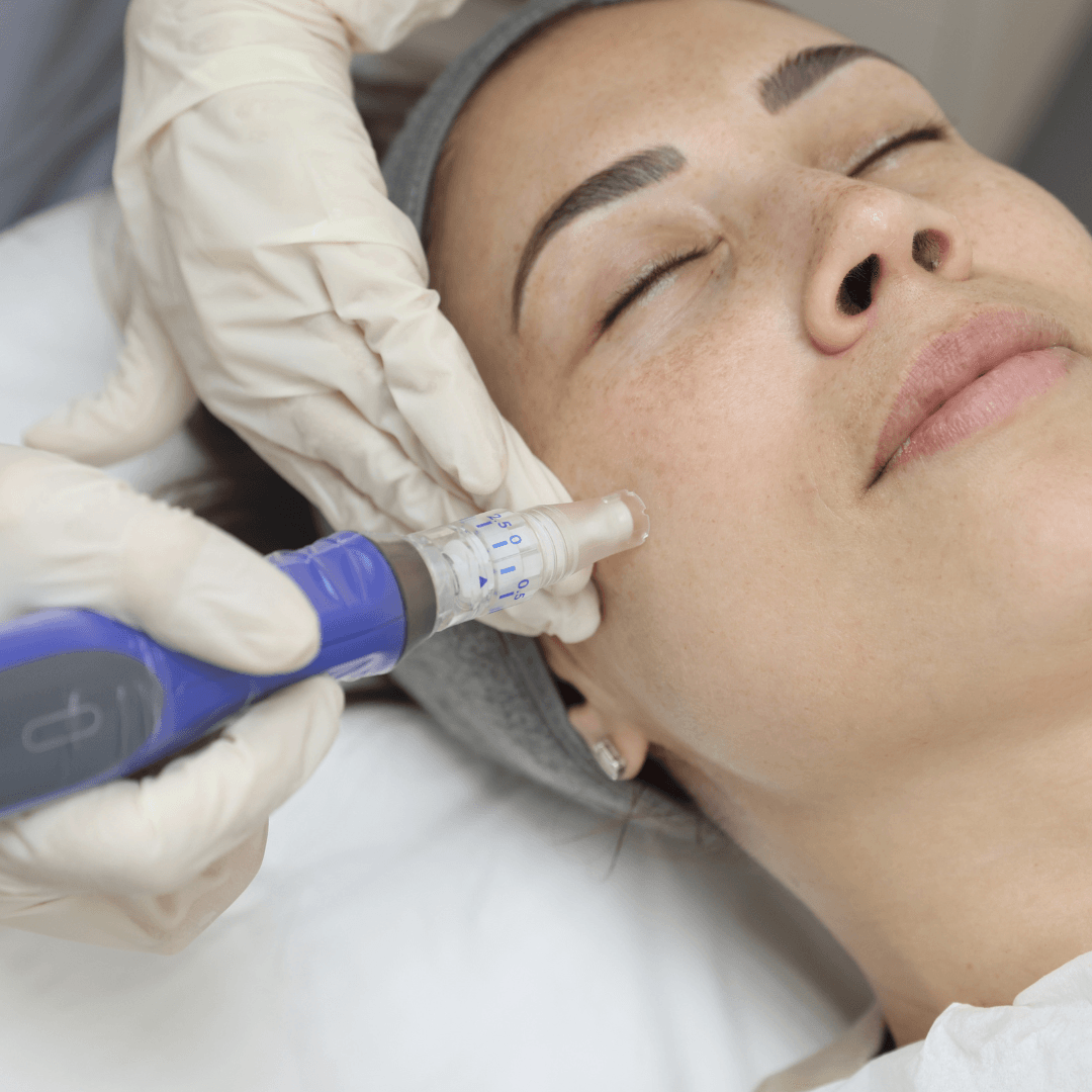 SkinPen Microneedling | Boost Collagen Production | Omniya Clinic London